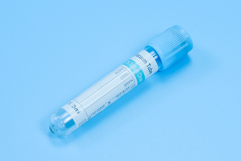 Types and introduction of Vacuum Blood Collection Tube - Shanghai Union ...